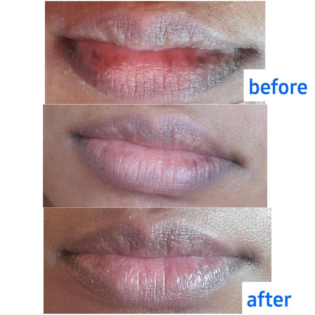 Lip Lightening Balm for Dark Lips | Lip Brightening & Whitening ...