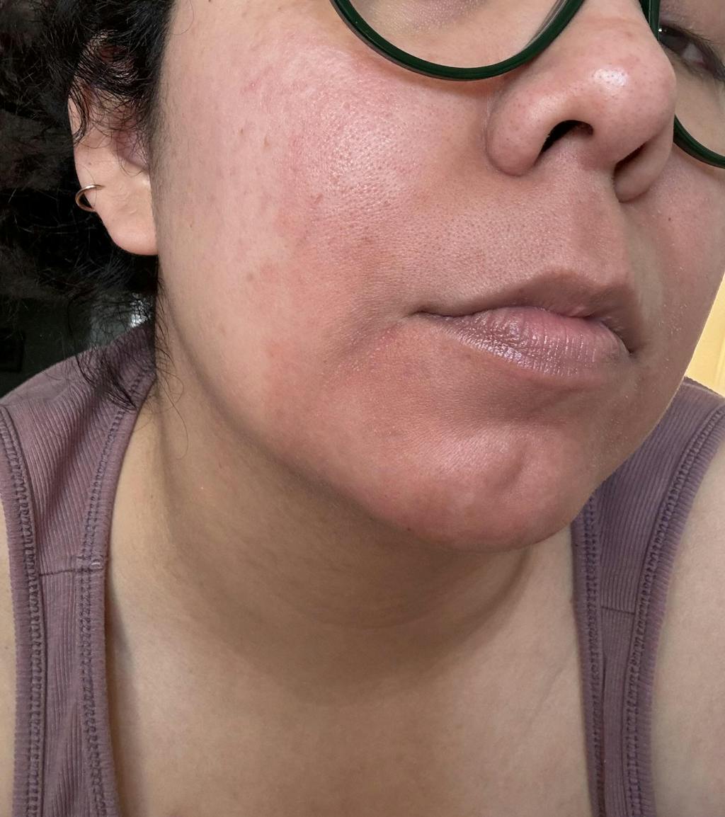 Onekind Dream Cream Nighttime Moisturizer - Non Comedogenic