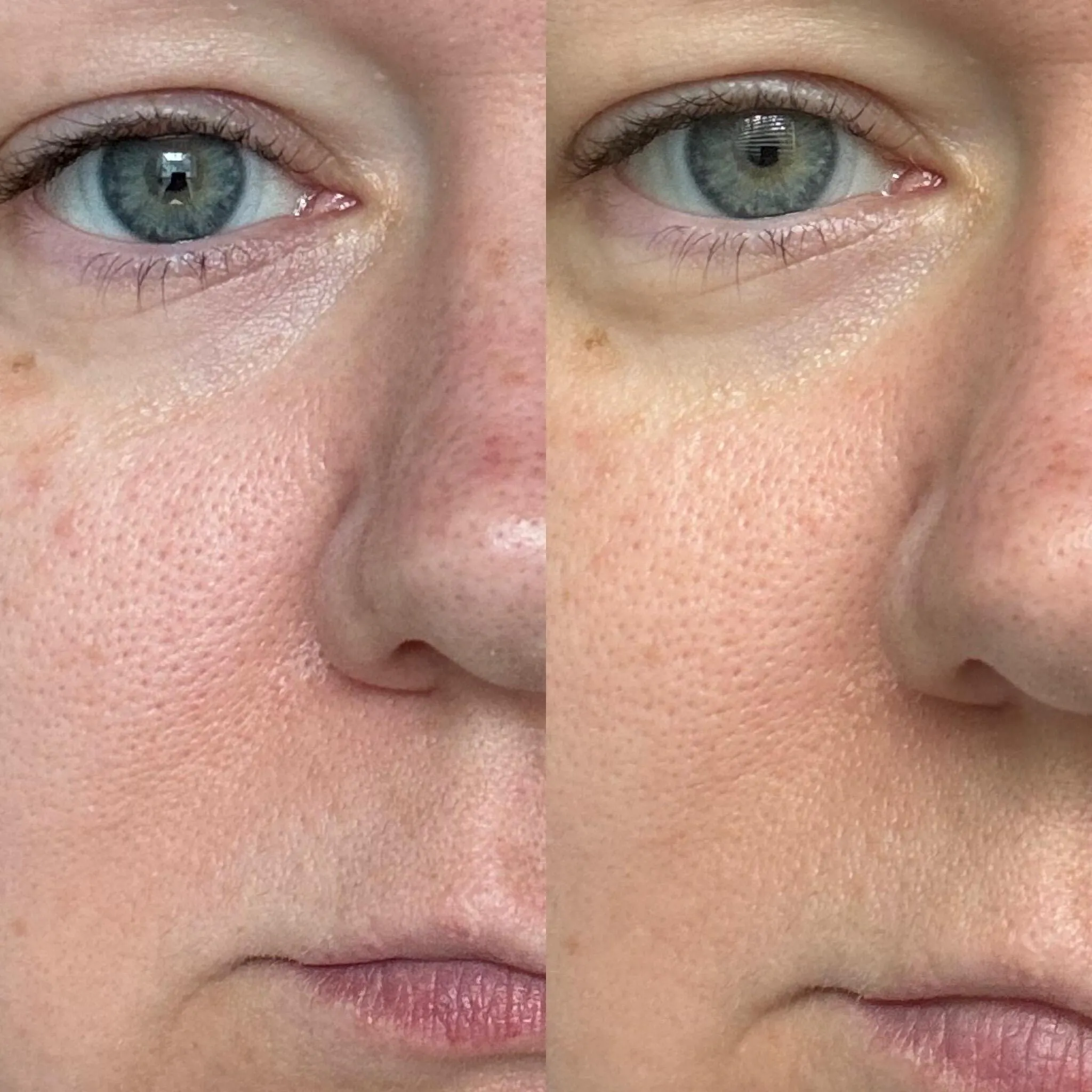 Onekind Dream Cream Nighttime Moisturizer - Non Comedogenic