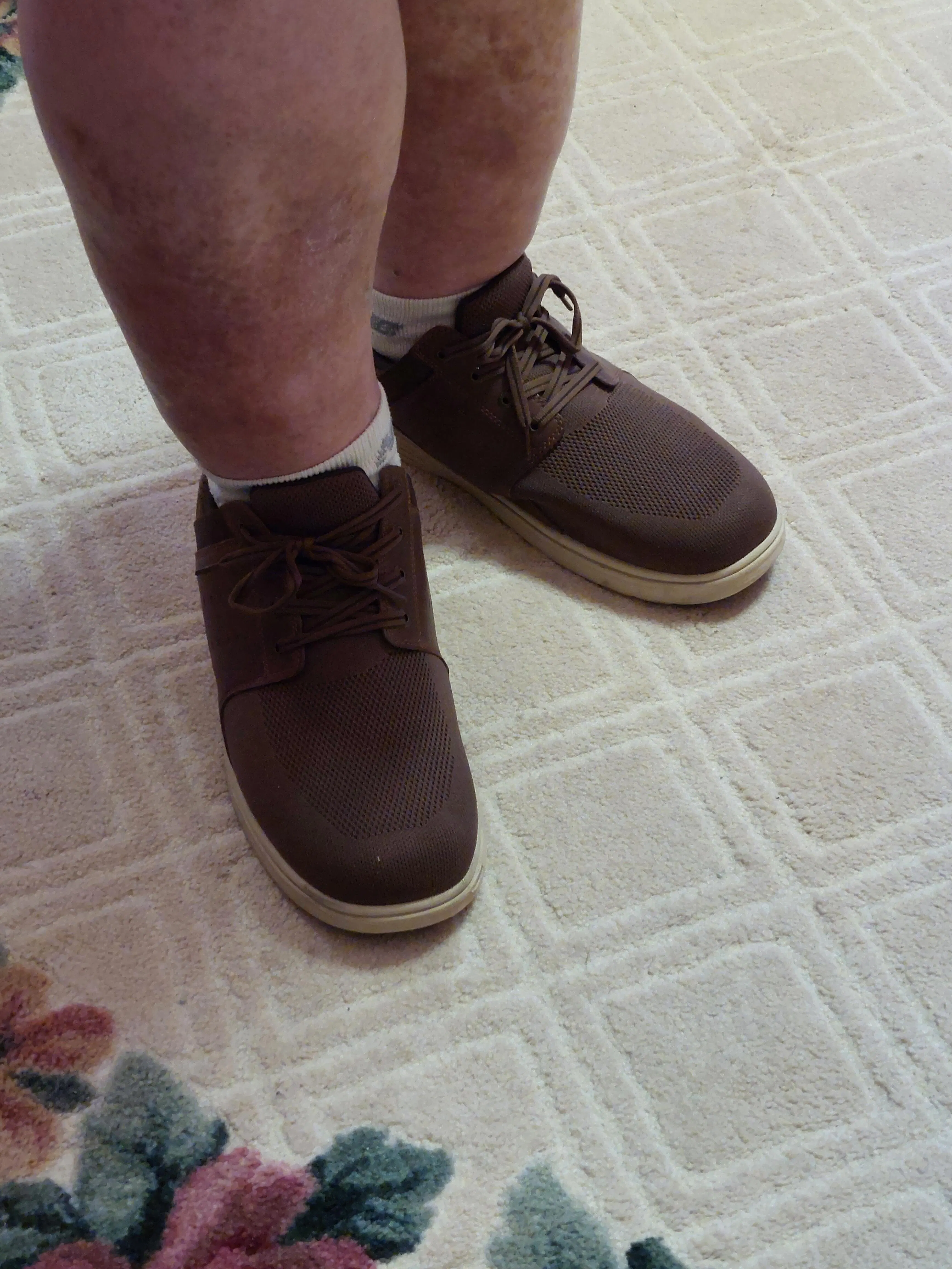 Men's Orthopedic Casual Shoes | Siron Hands-Free Shoe - Brown – OrthoFeet