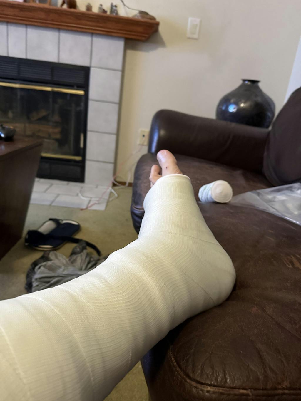 Long Leg Cast - Medical Cast