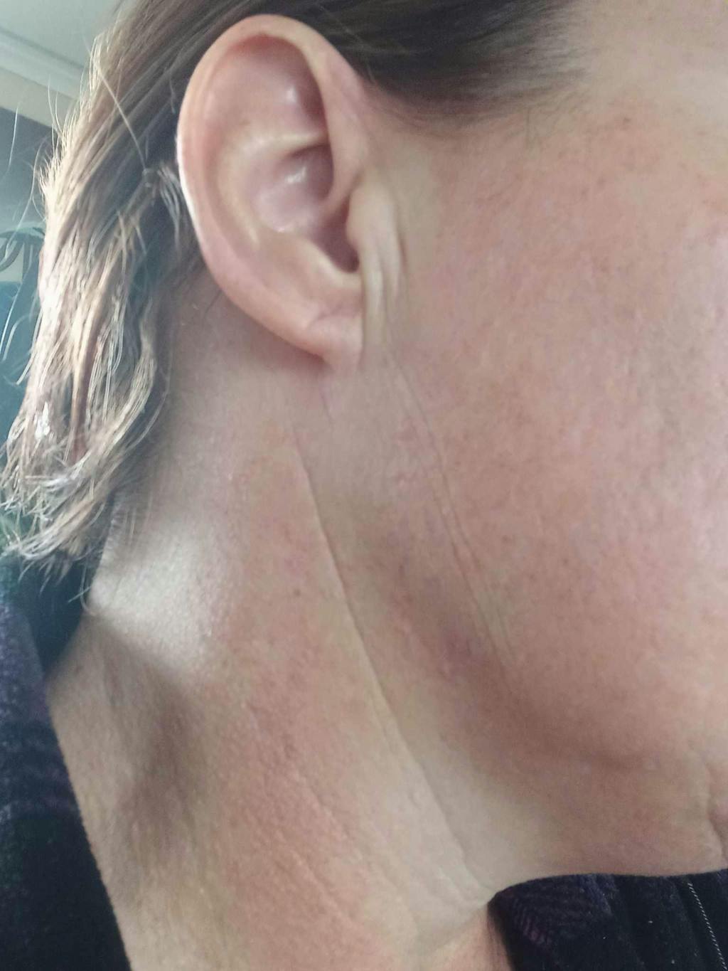 Pal's Skin Lab - High Performance Skincare - See Results in 4 weeks ...