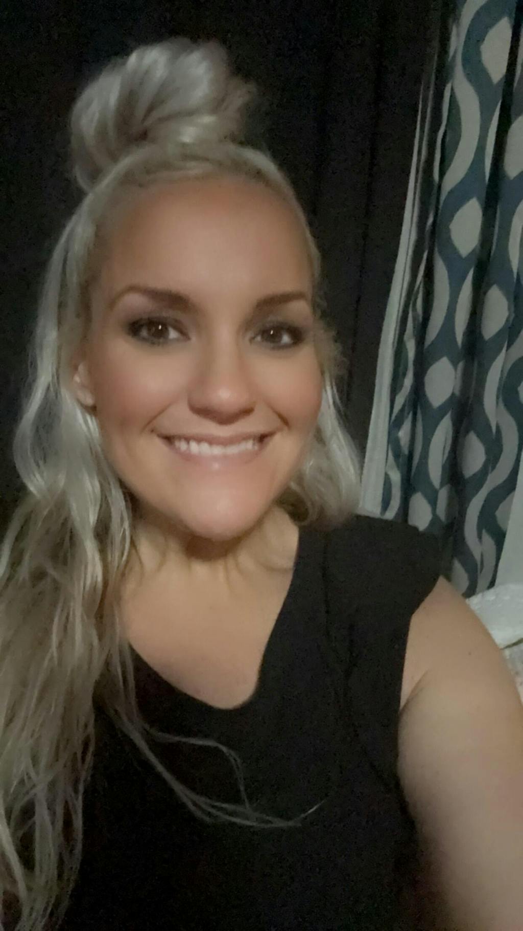 Custom Flipper Stayplate Tooth Acrylic Partial Denture – PatrickDeanDent