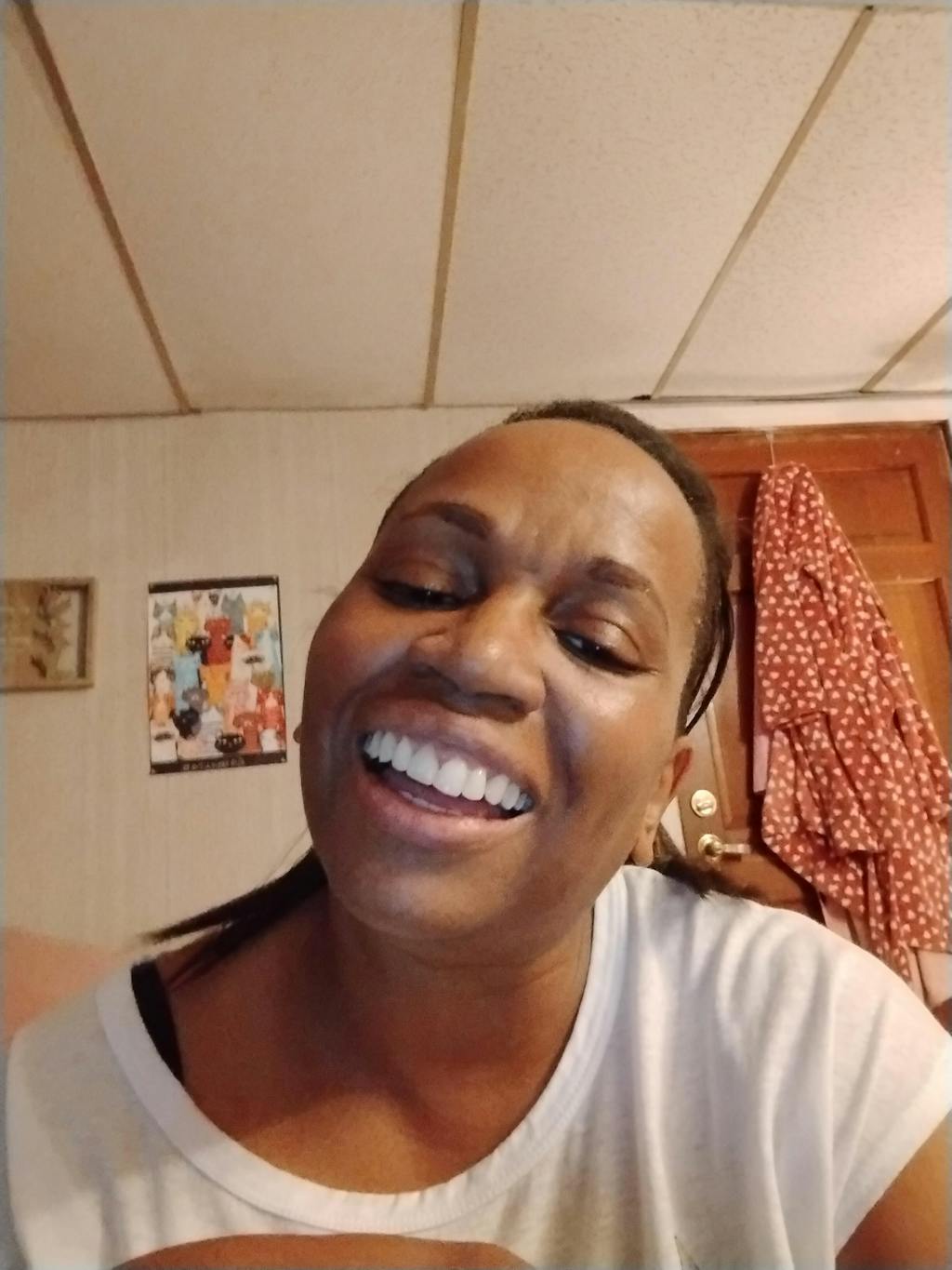 Online Custom Flipper Acrylic Partial Upper Lower Denture – PatrickDeanDent