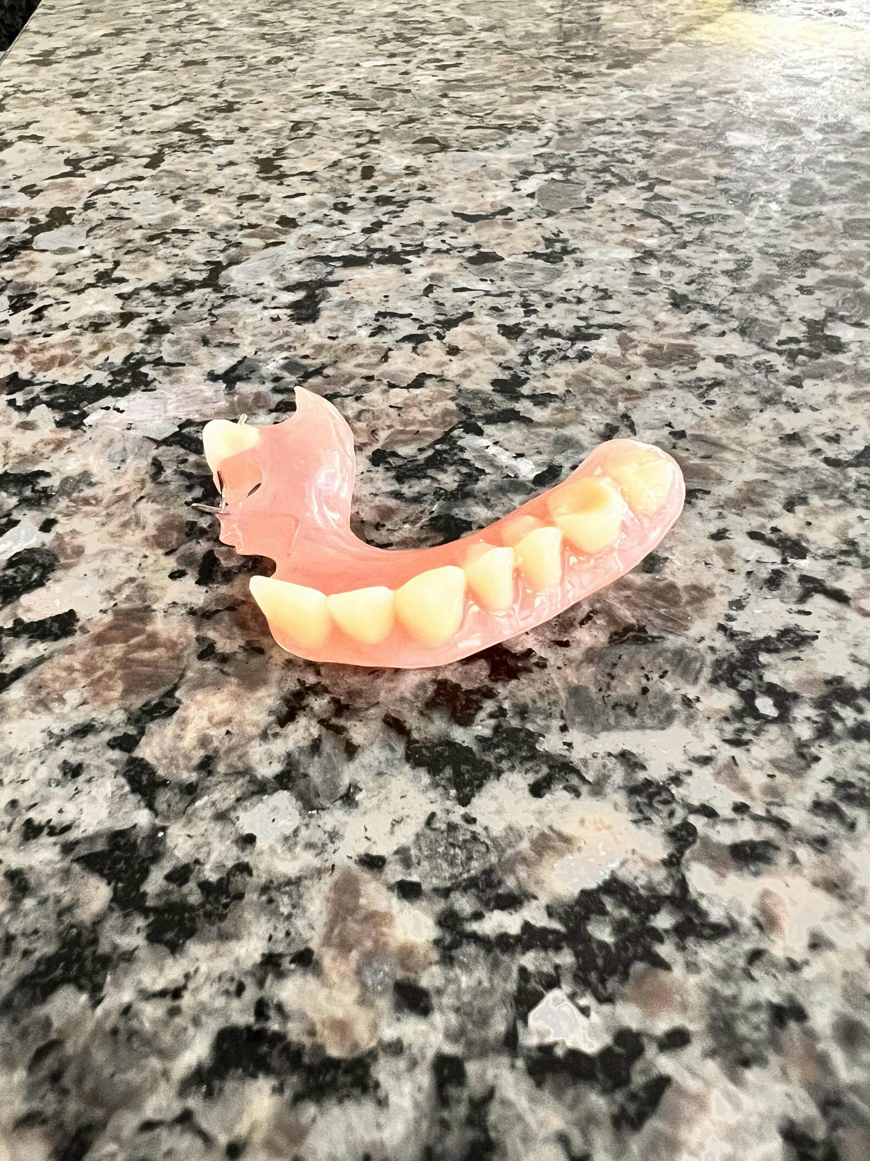 Online Custom Flipper Acrylic Partial Upper Lower Denture – PatrickDeanDent