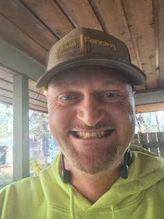 Custom Partials & Full Dentures - Missing Tooth & Teeth Online Denture ...