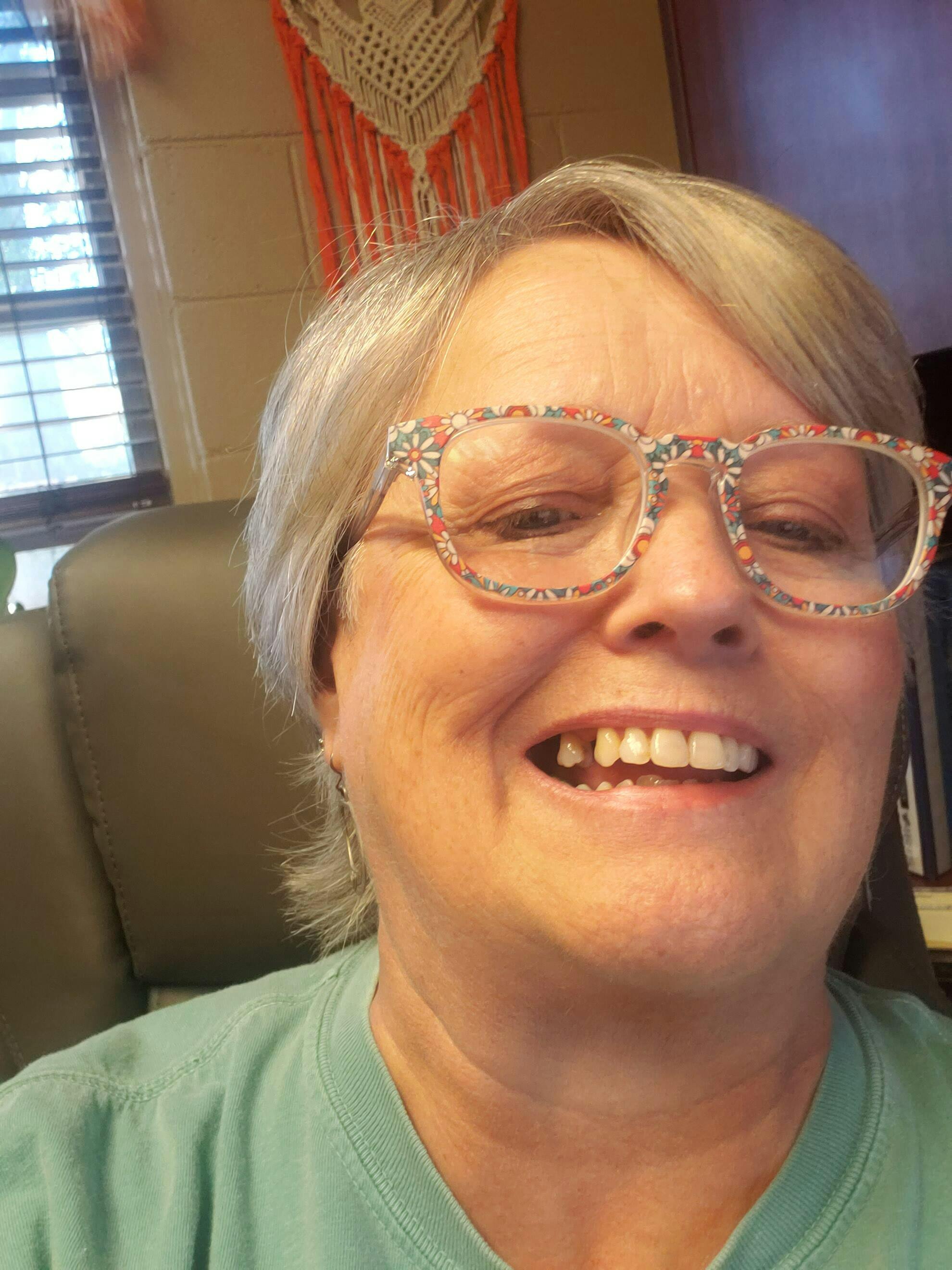 Custom Partials & Full Dentures - Missing Tooth & Teeth Online Denture ...