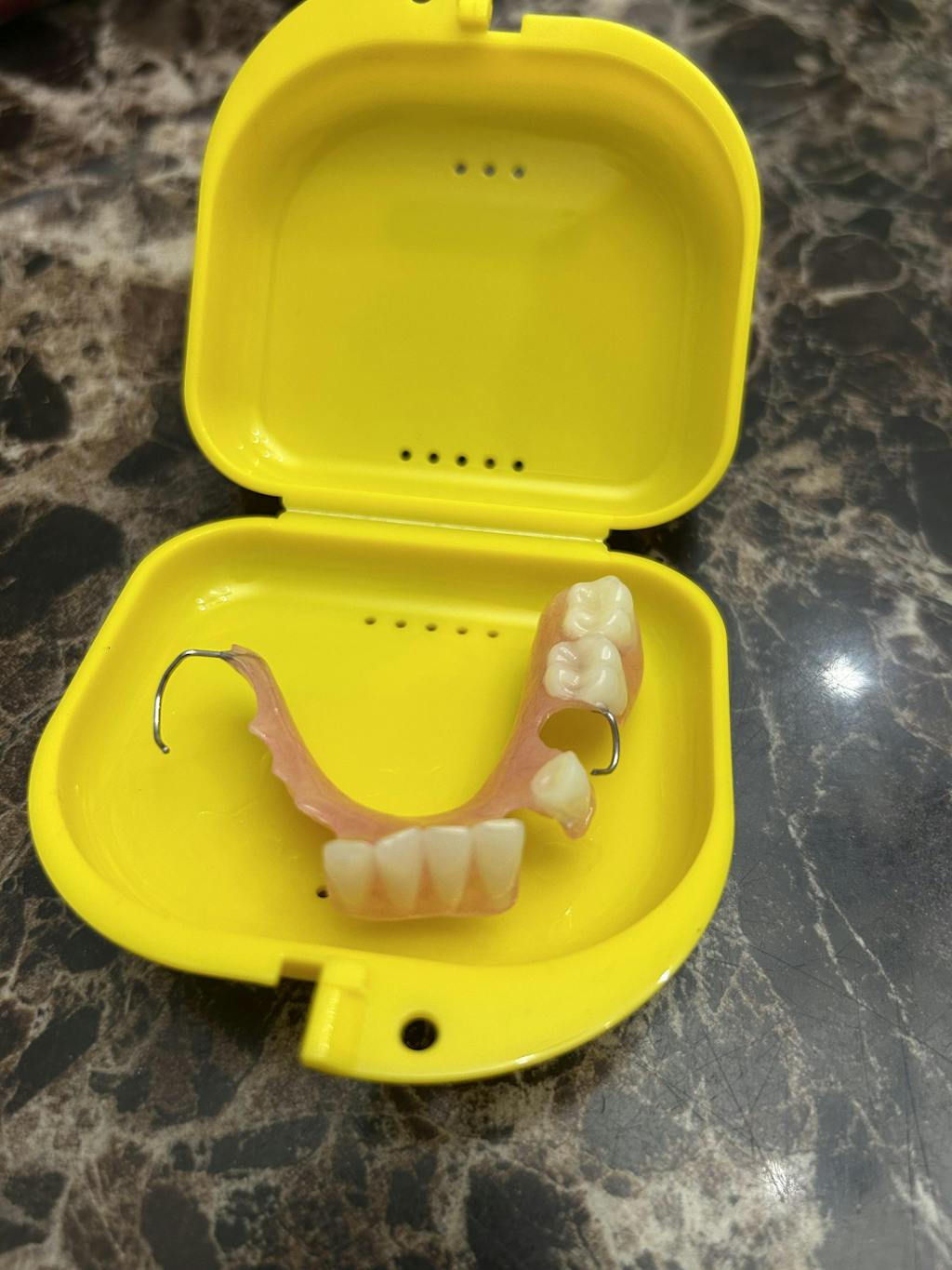 Online Custom Flipper Acrylic Partial Upper Lower Denture – PatrickDeanDent