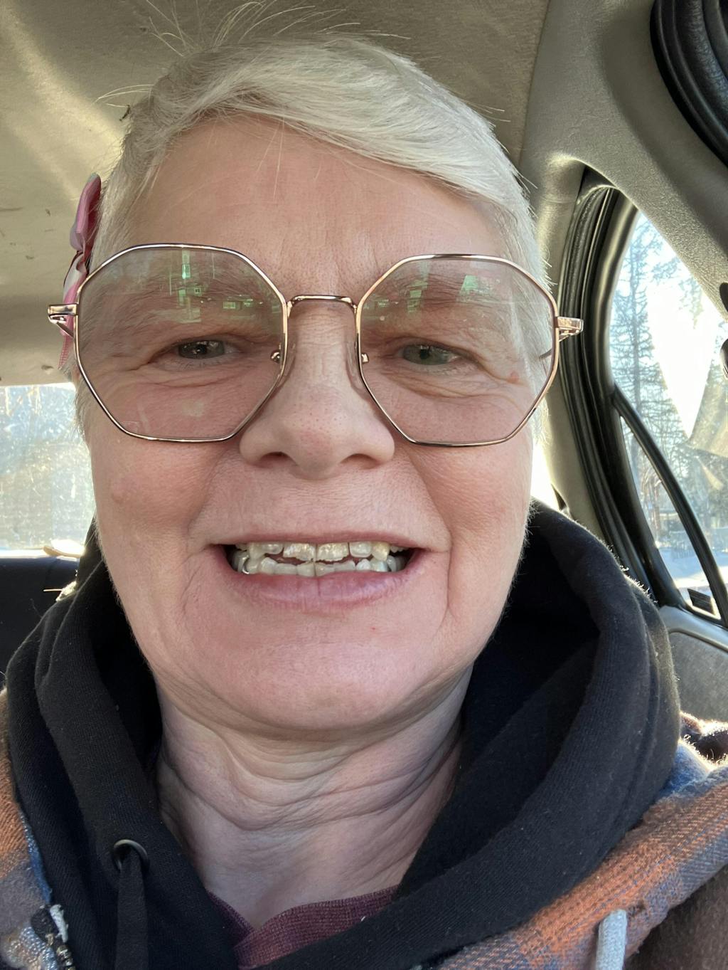 Custom Partials & Full Dentures - Missing Tooth & Teeth Online Denture ...