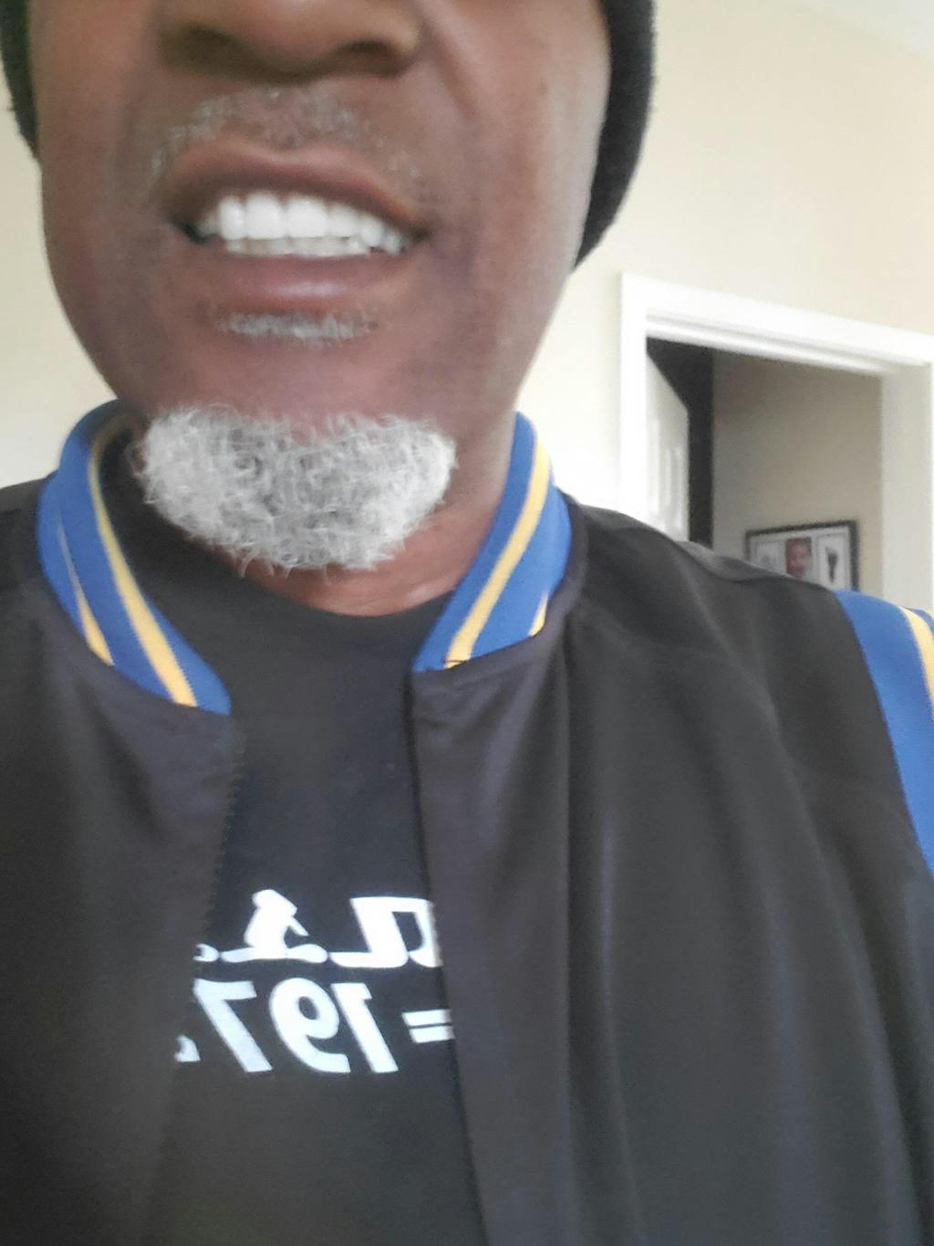 Custom Partials & Full Dentures - Missing Tooth & Teeth Online Denture ...