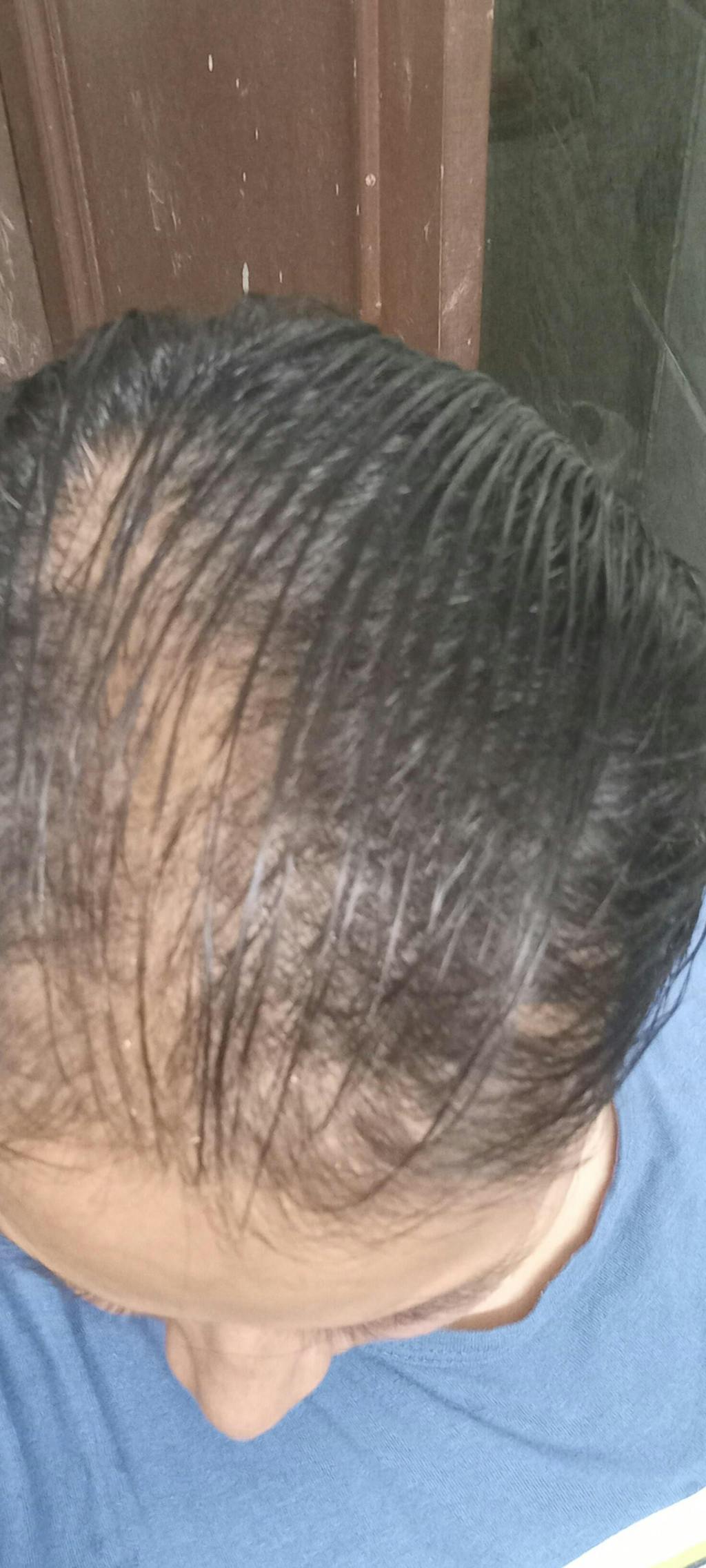 Buy 3% Redensyl & 4% Anagain Advanced Hair Growth Serum Online