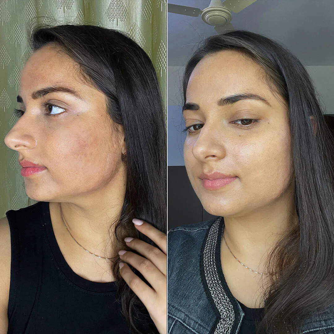 Glowy Skin Effervescent with 500mg Glutathione – Plixlife USA