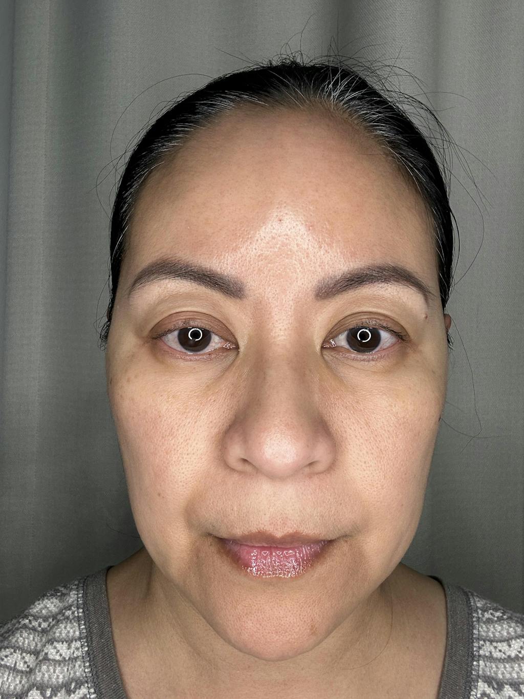 LumaLux Face | Pro LED Light Therapy Mask | Project E Beauty United States