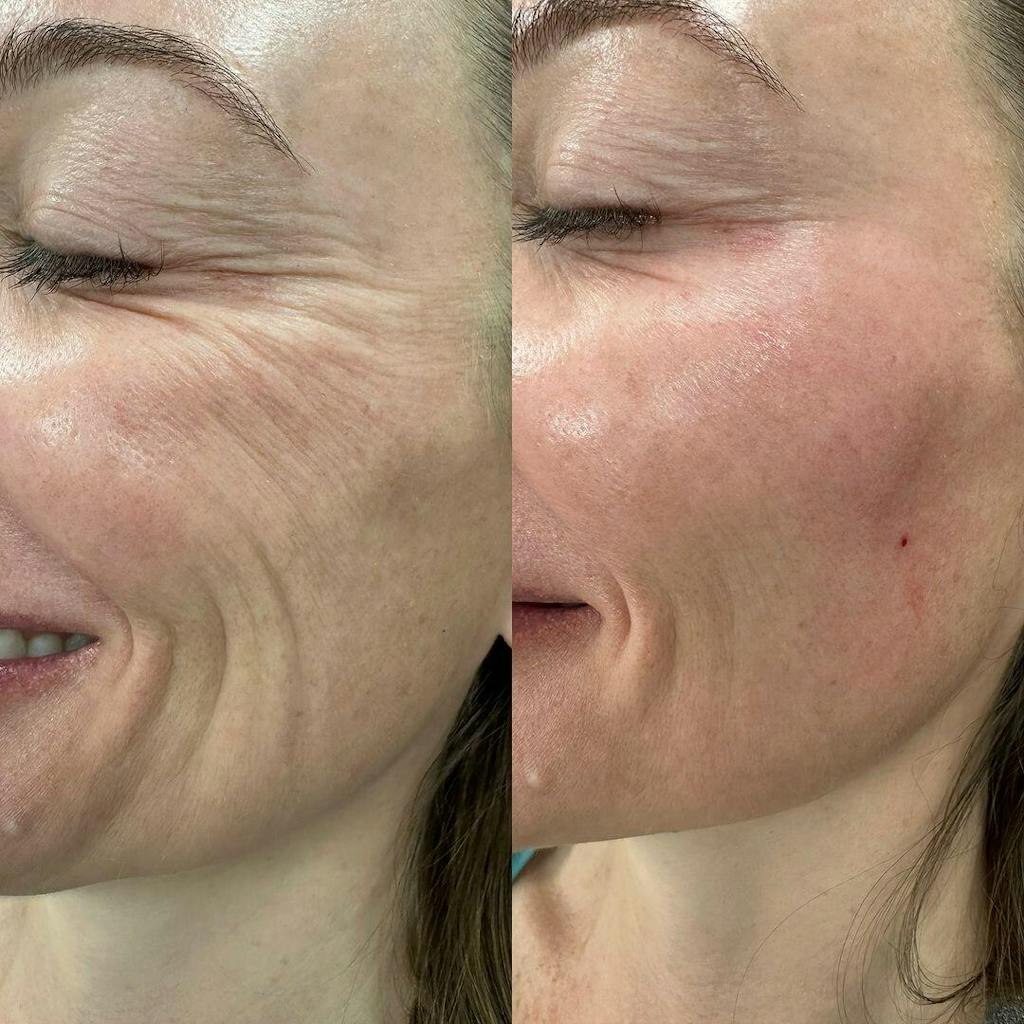 RedMD Pro Plus Edition