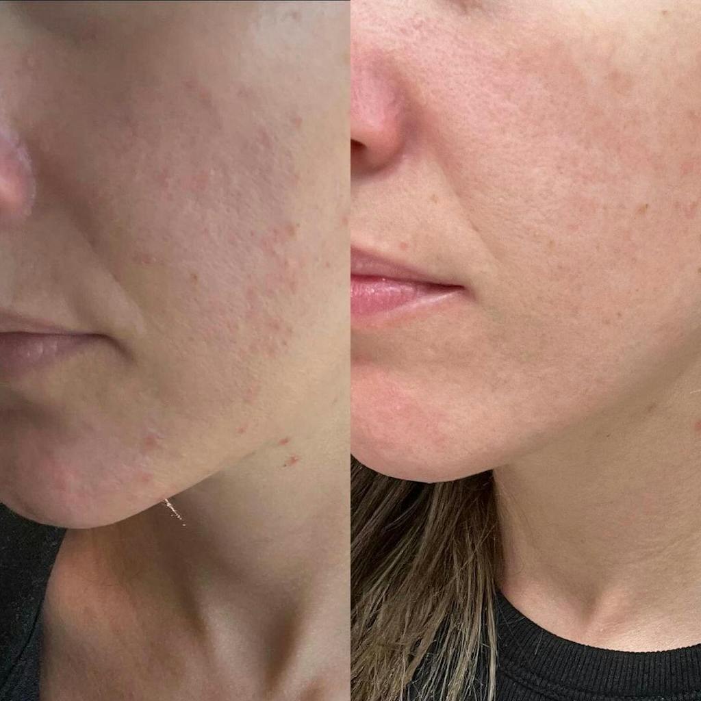 RedMD Pro Plus Edition