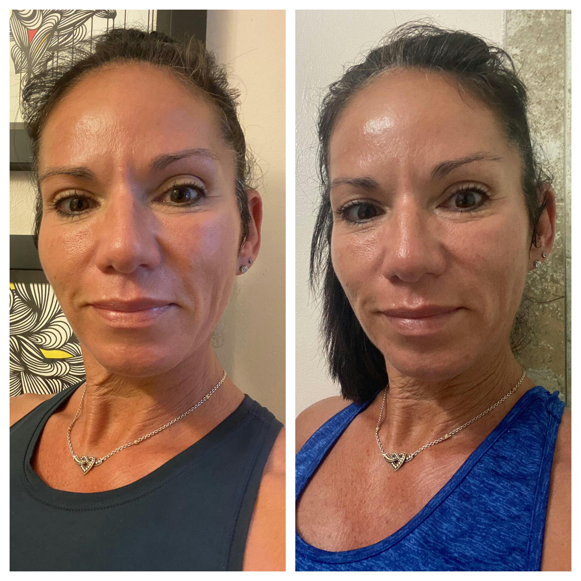 Liquid Facelift® Facial Cream - RegenLabs®