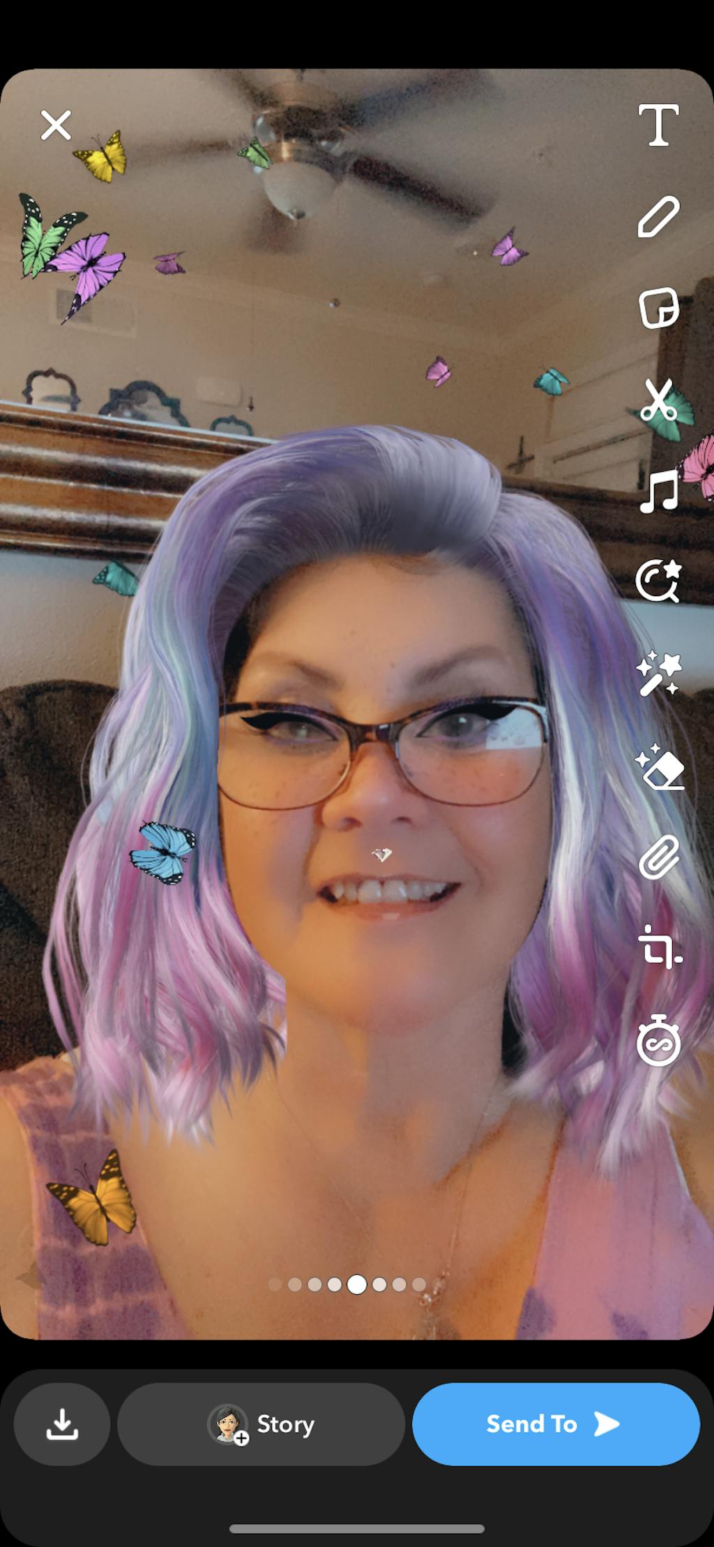 Learn More About the Flexible Partial Denture – Revived Smiles