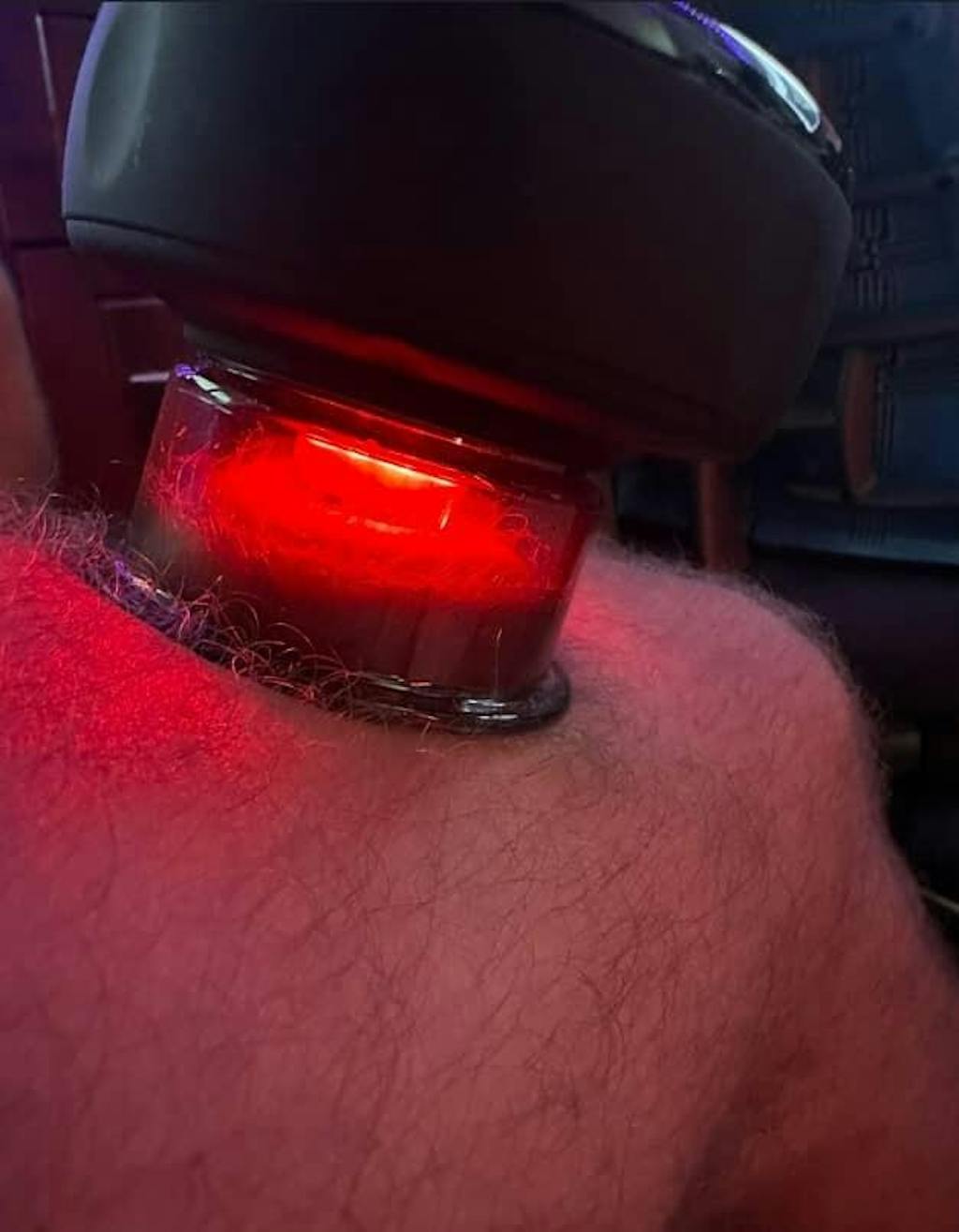 REVO™ Smart Cupping Therapy Massager – Revomadic