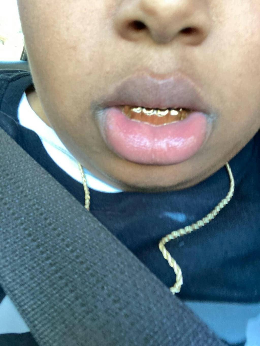 Vampire Gold Plated Fang Grillz [Full Set] – Rhino Grillz