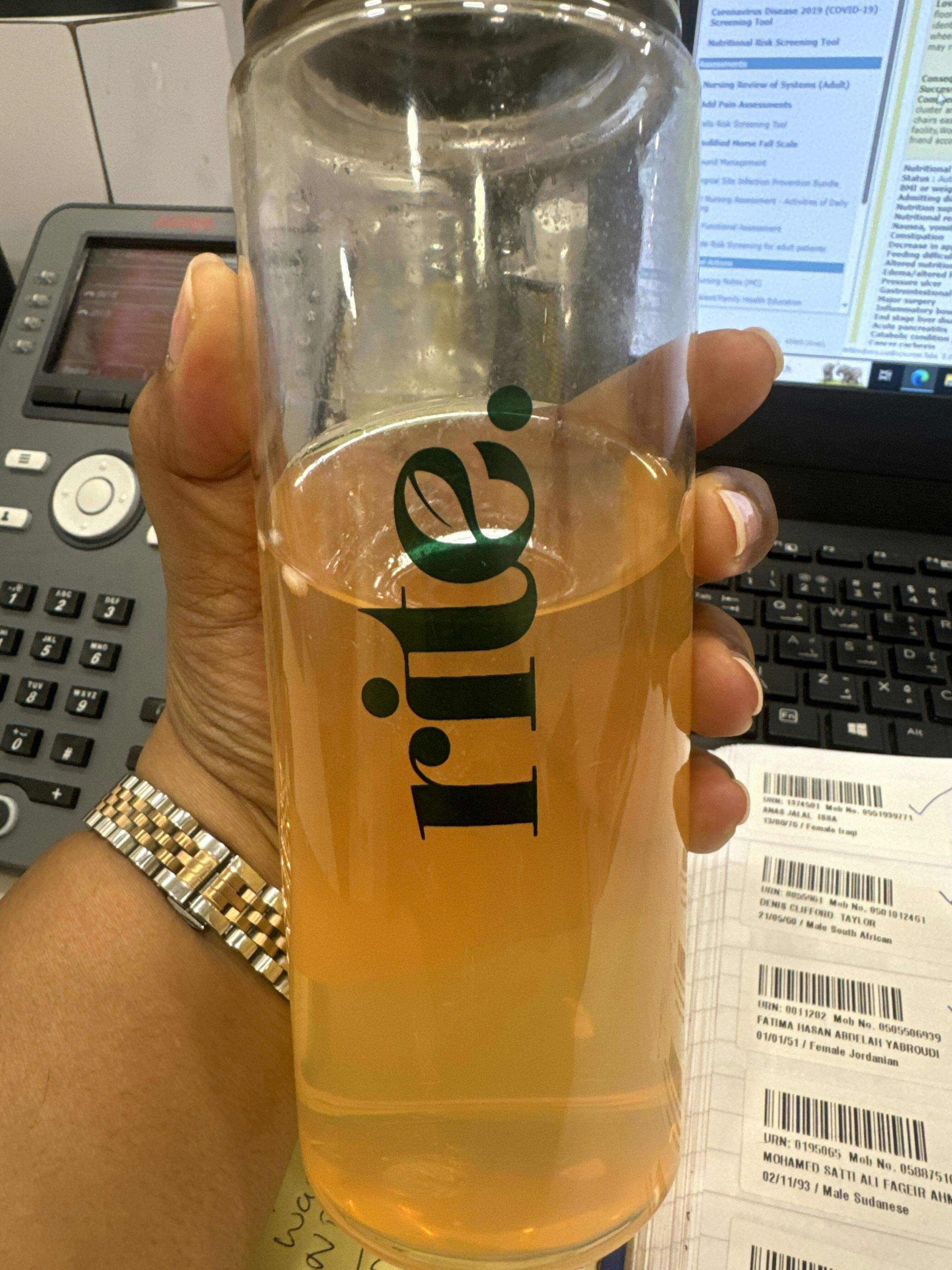 Boost Your Gut Health with Rite's Prebiotic Powder Drink – RITE.®