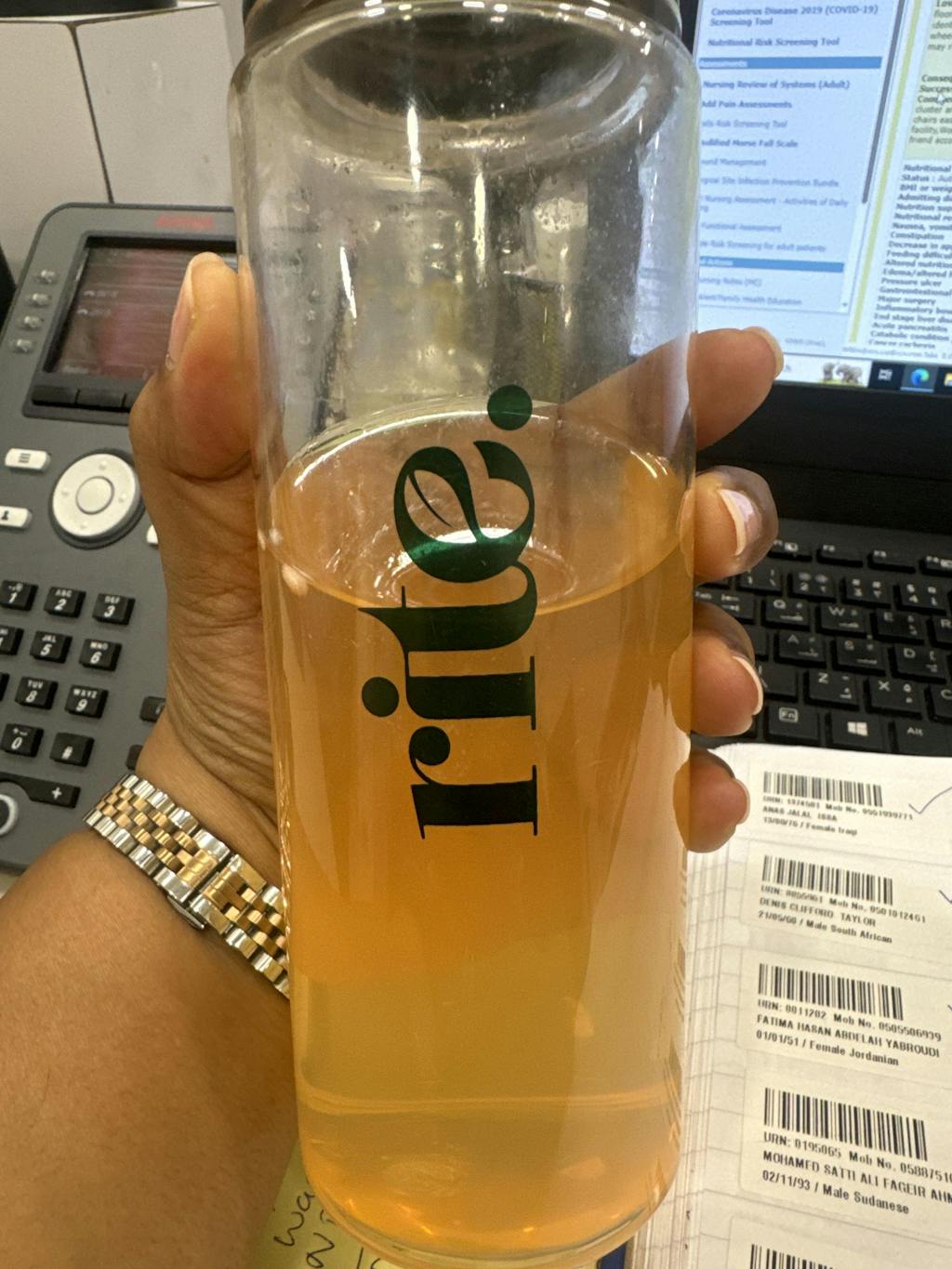 Boost Your Gut Health with Rite's Prebiotic Powder Drink – RITE.®