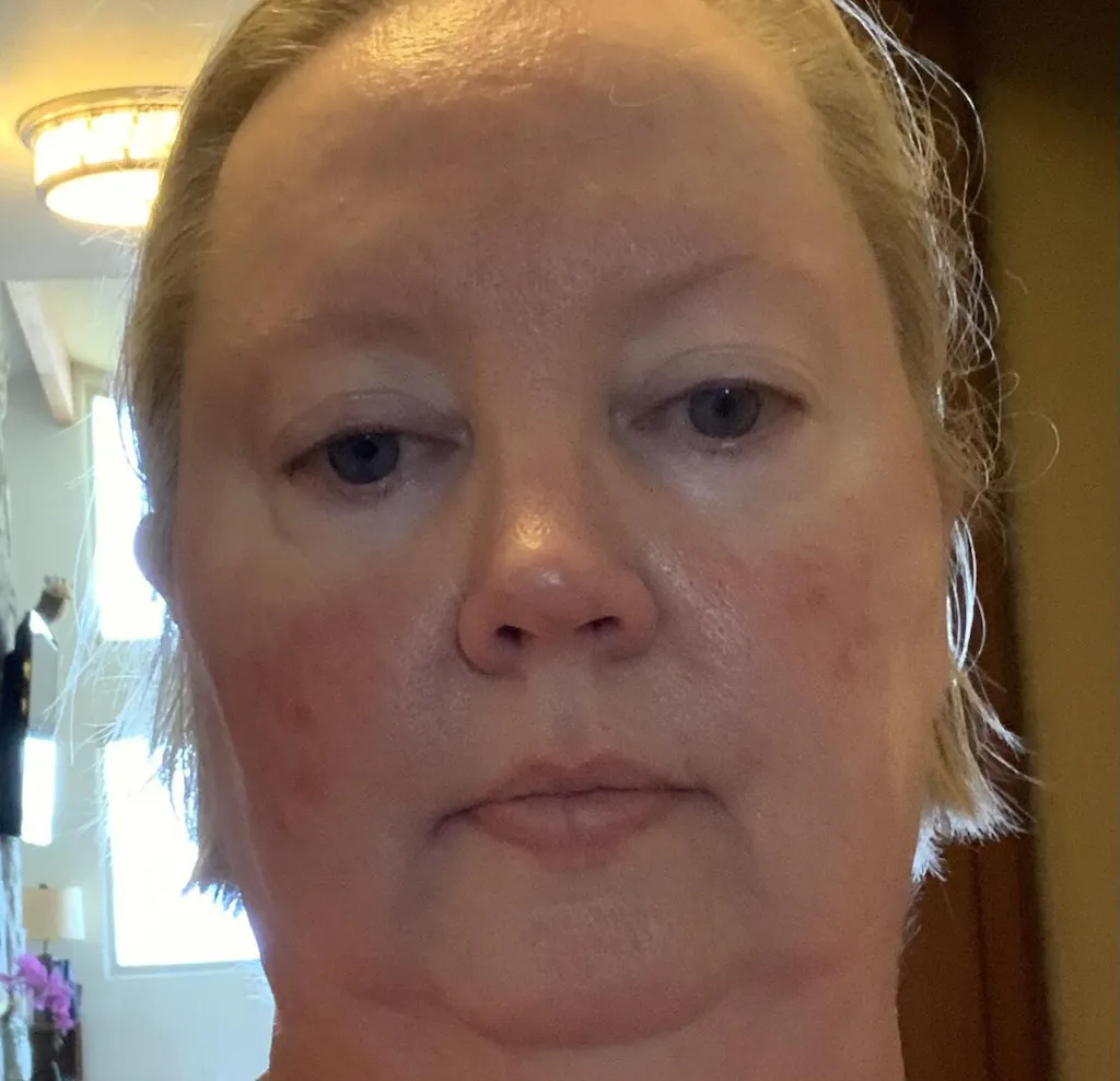 Redness Calming Mask | Riversol Dermatologist Developed Skincare
