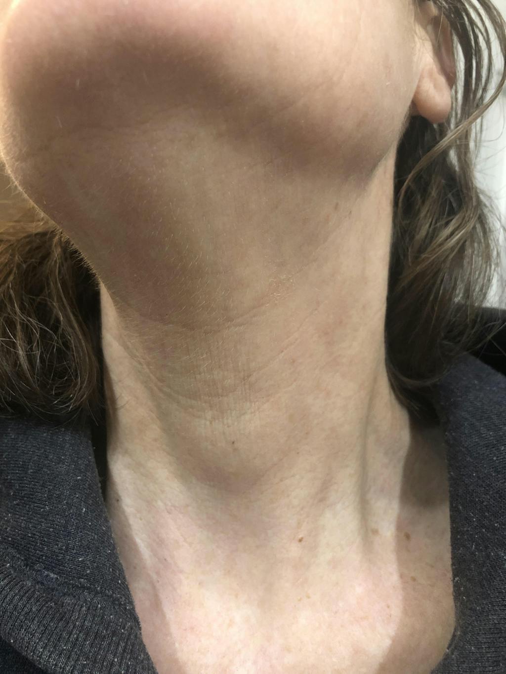 Retinol Neck Cream Refill – Riversol