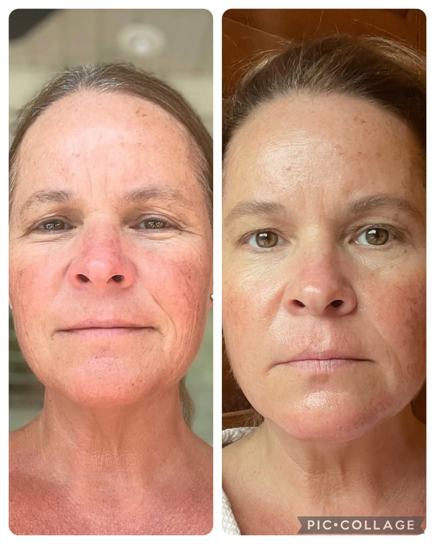 Anti-Aging Trio with Eye Repair | Riversol Derm Developed