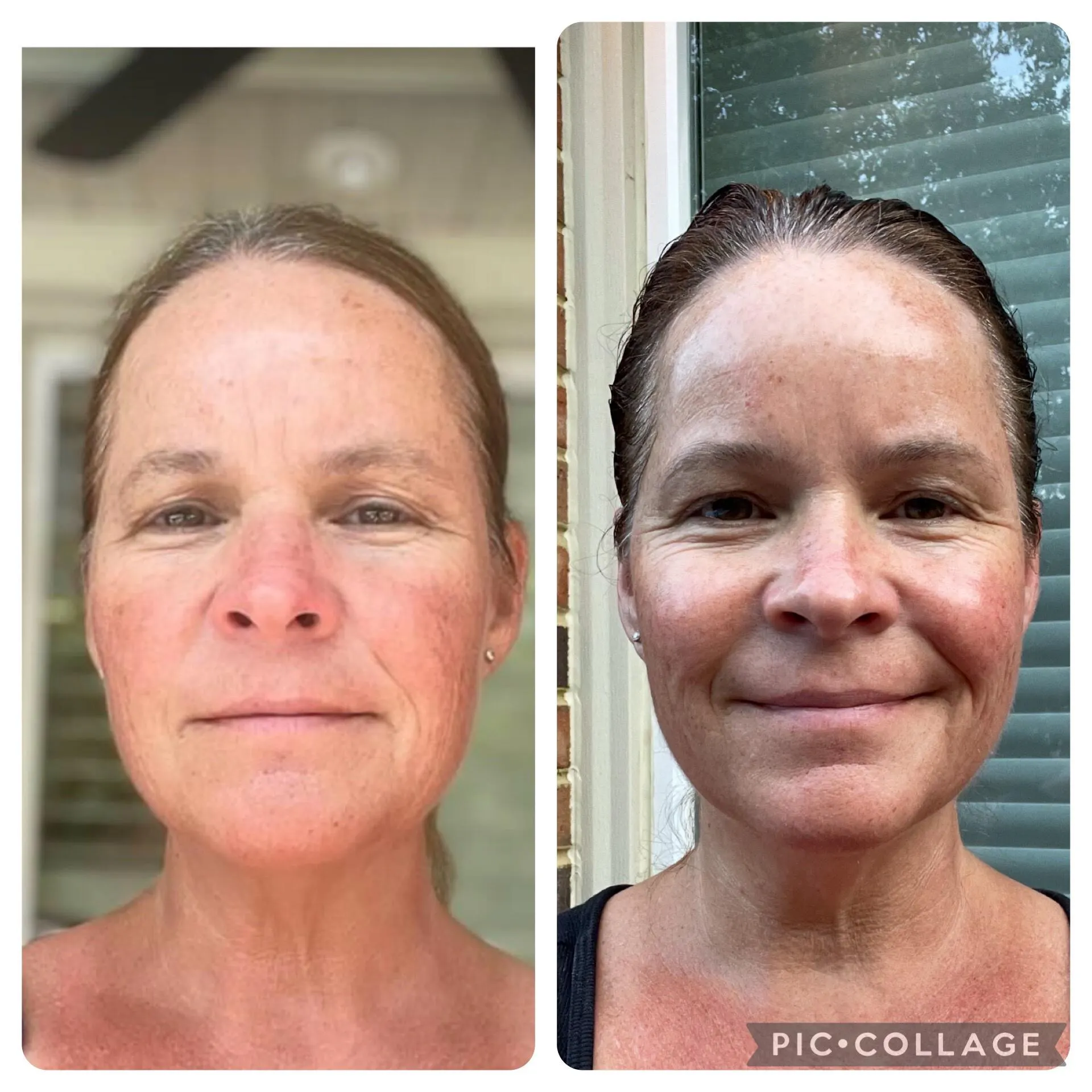 Anti-Aging Trio with Eye Repair | Riversol Derm Developed