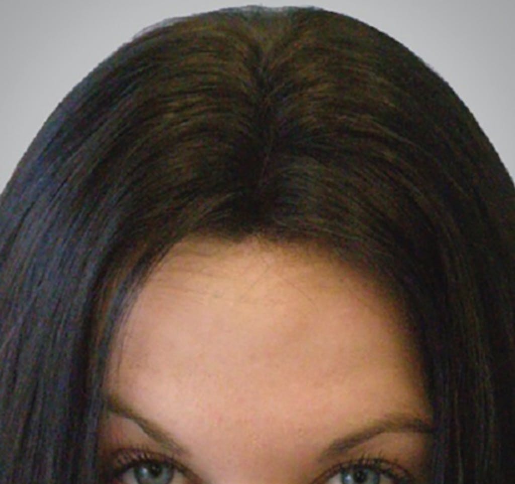 Pixie Human Hair and Handmade Topper – SEULLY