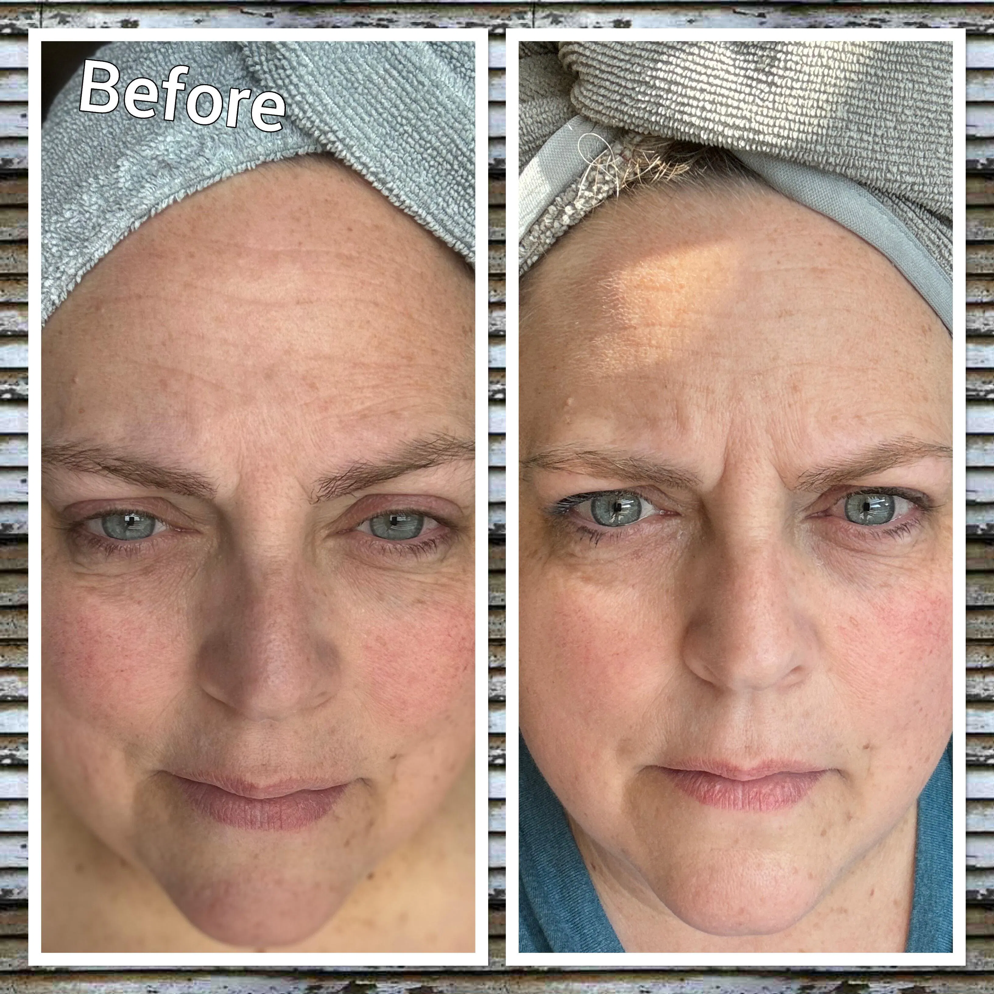Methylene Blue Serum - Antioxidant Anti-Aging Skincare – SEVO
