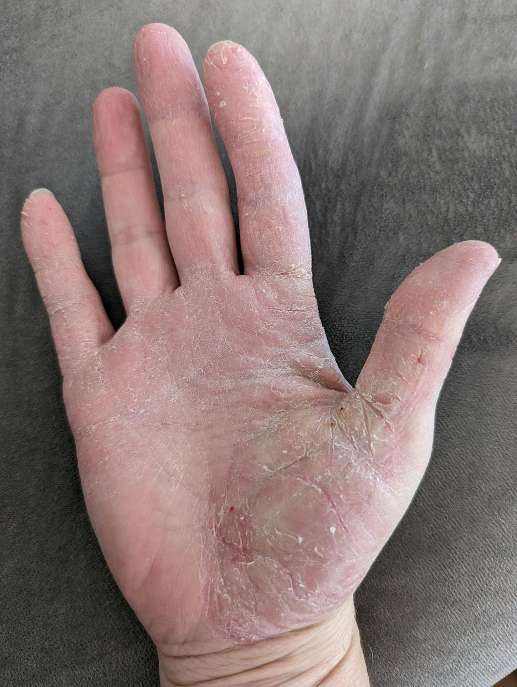 Skinesa® | Best Probiotic Supplements for Skin Health | Probiotic Pills ...