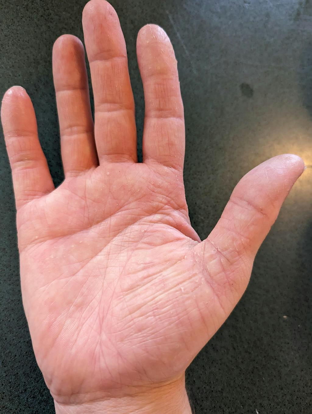 Skinesa® | Best Probiotic Supplements for Skin Health | Probiotic Pills ...