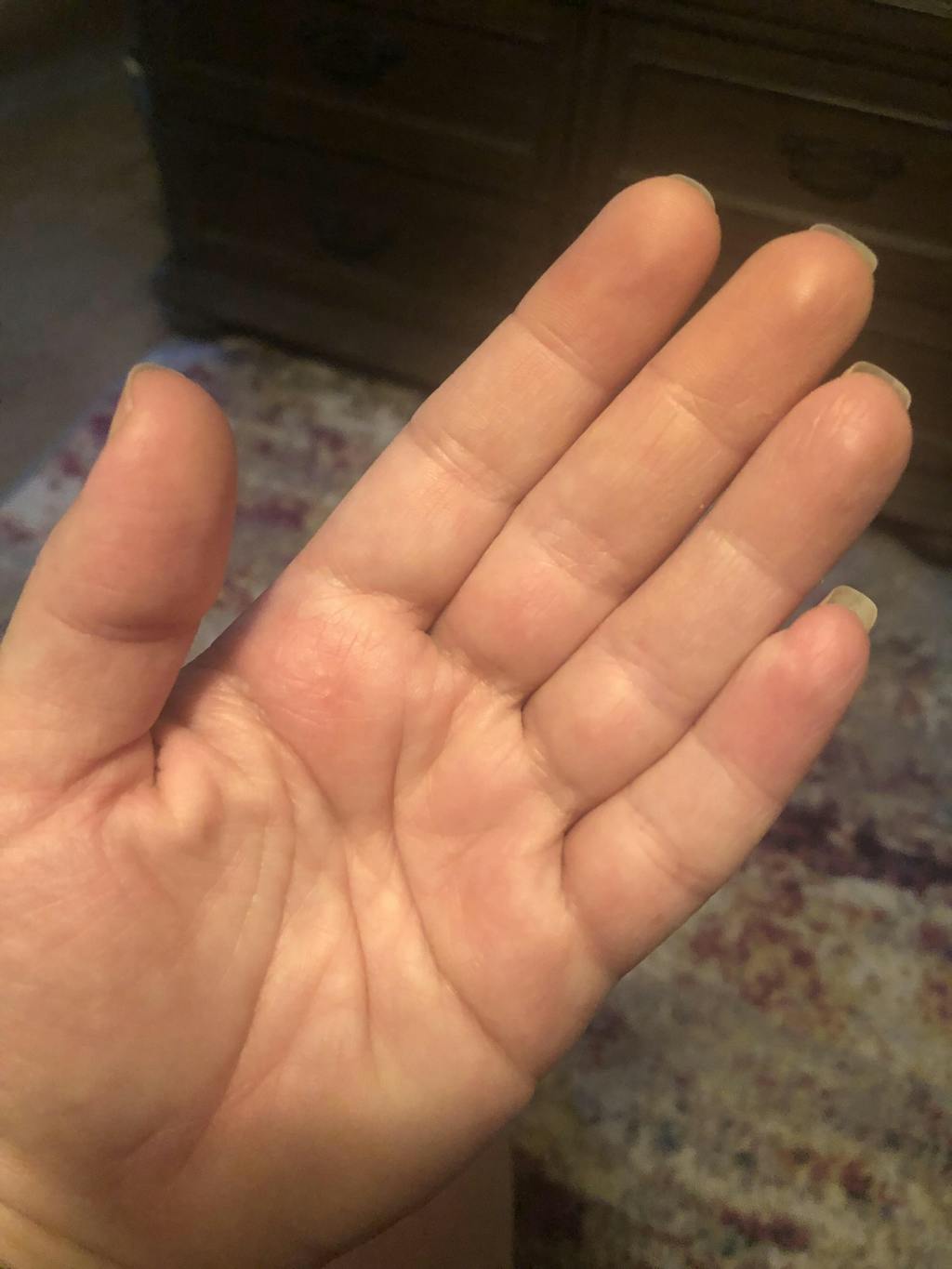 Skinesa® | Best Probiotic Supplements for Skin Health | Probiotic Pills ...