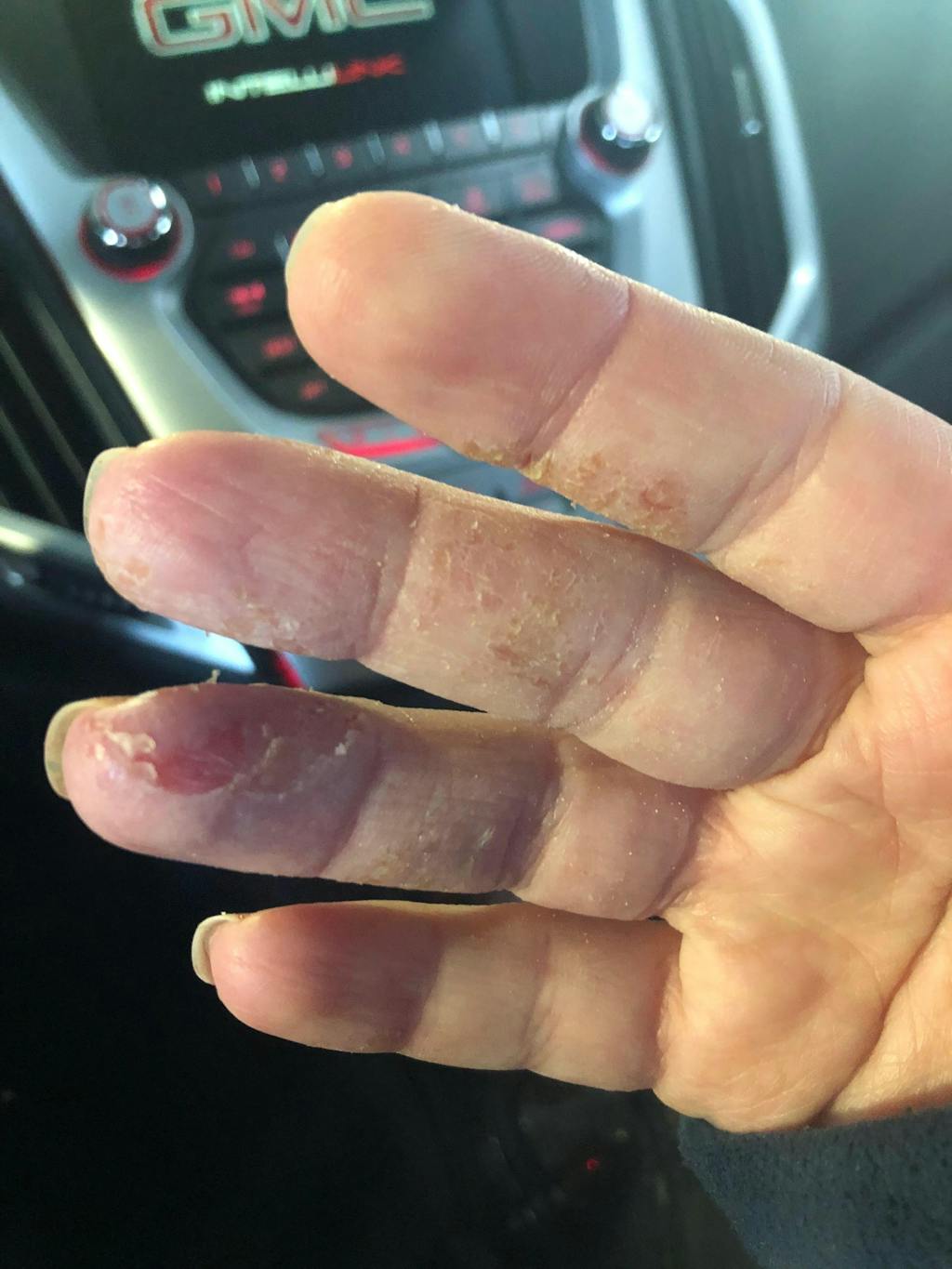 Skinesa® | Best Probiotic Supplements for Skin Health | Probiotic Pills ...