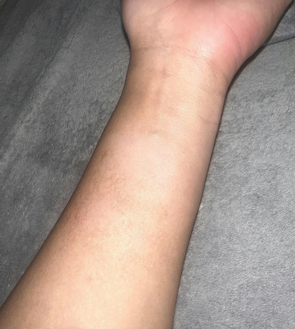 Skinesa® | Best Probiotic Supplements for Skin Health | Probiotic Pills ...