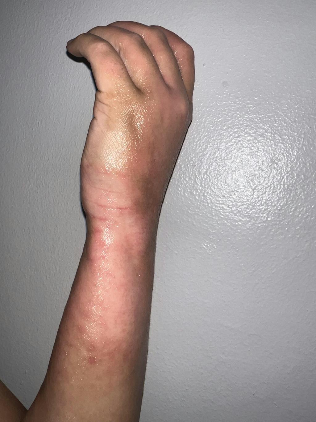 Skinesa® | Best Probiotic Supplements for Skin Health | Probiotic Pills ...