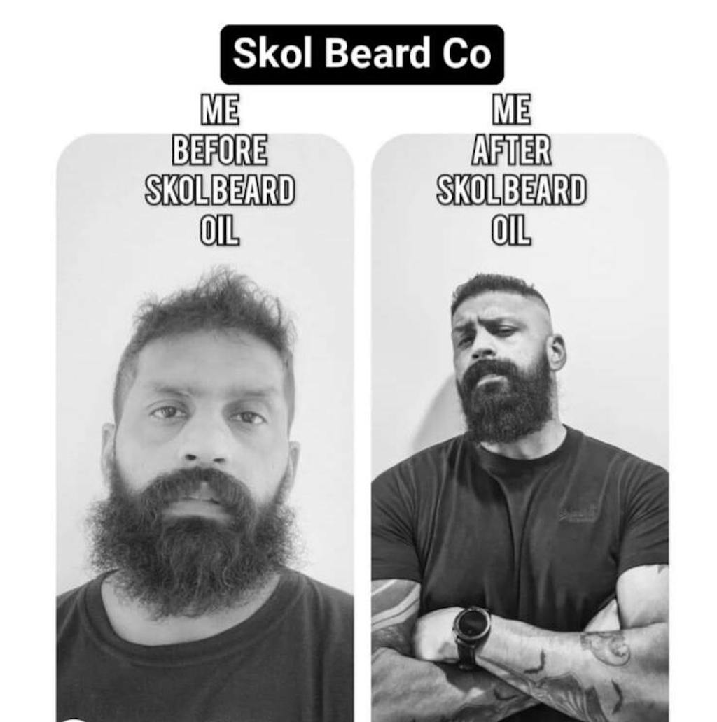 BEARD GROOMING QUIZ – SKOL BEARD CO