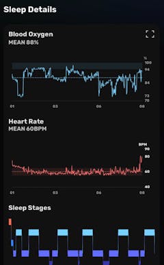GO2SLEEP to track sleep,screen sleep apnea,sleep apnea,sleep test ...