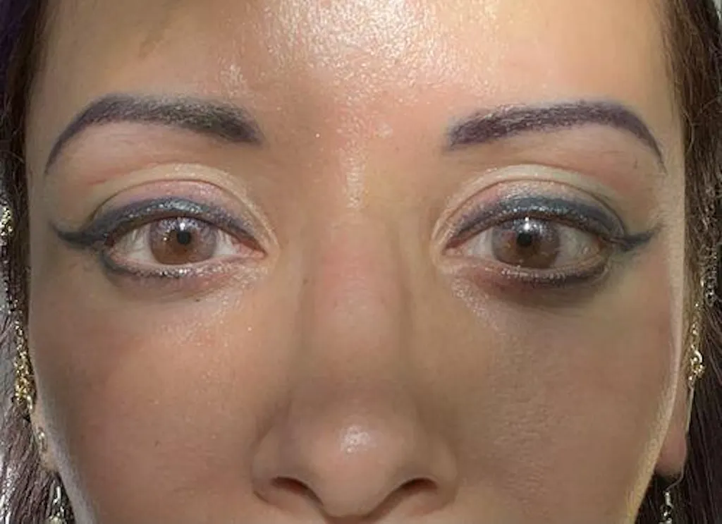 MICA Sparkle Oasis | Best Monthly Contact Lenses by Softlens Queen