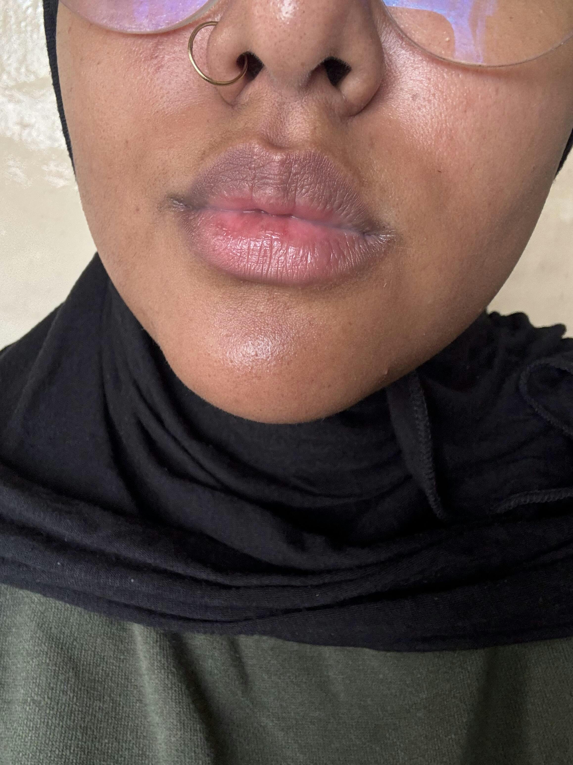 Peptide Lip Glaze with Hyaluronic Acid – Standard Skin & Beauty