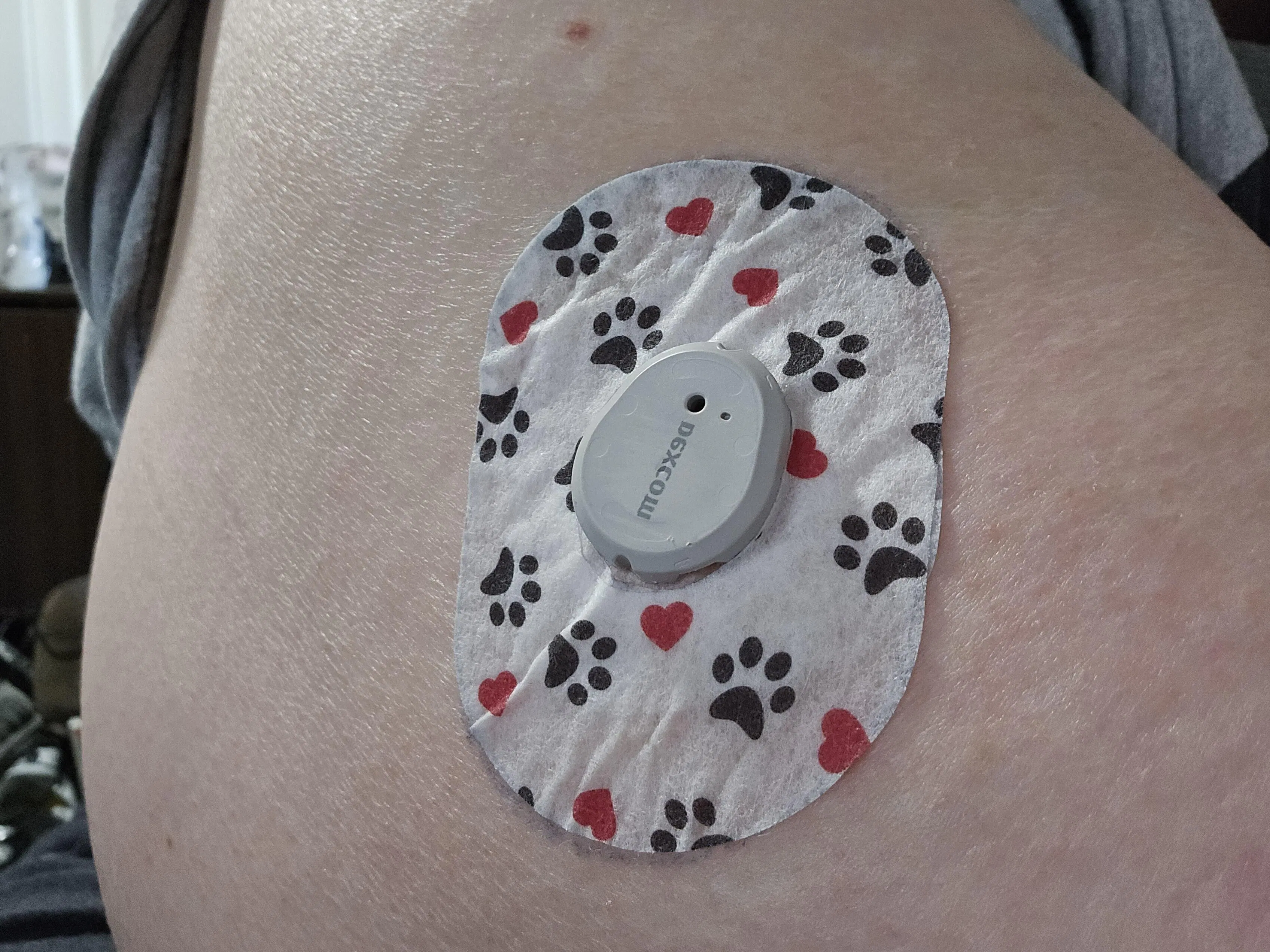 Flowers of Spring - Dexcom G6