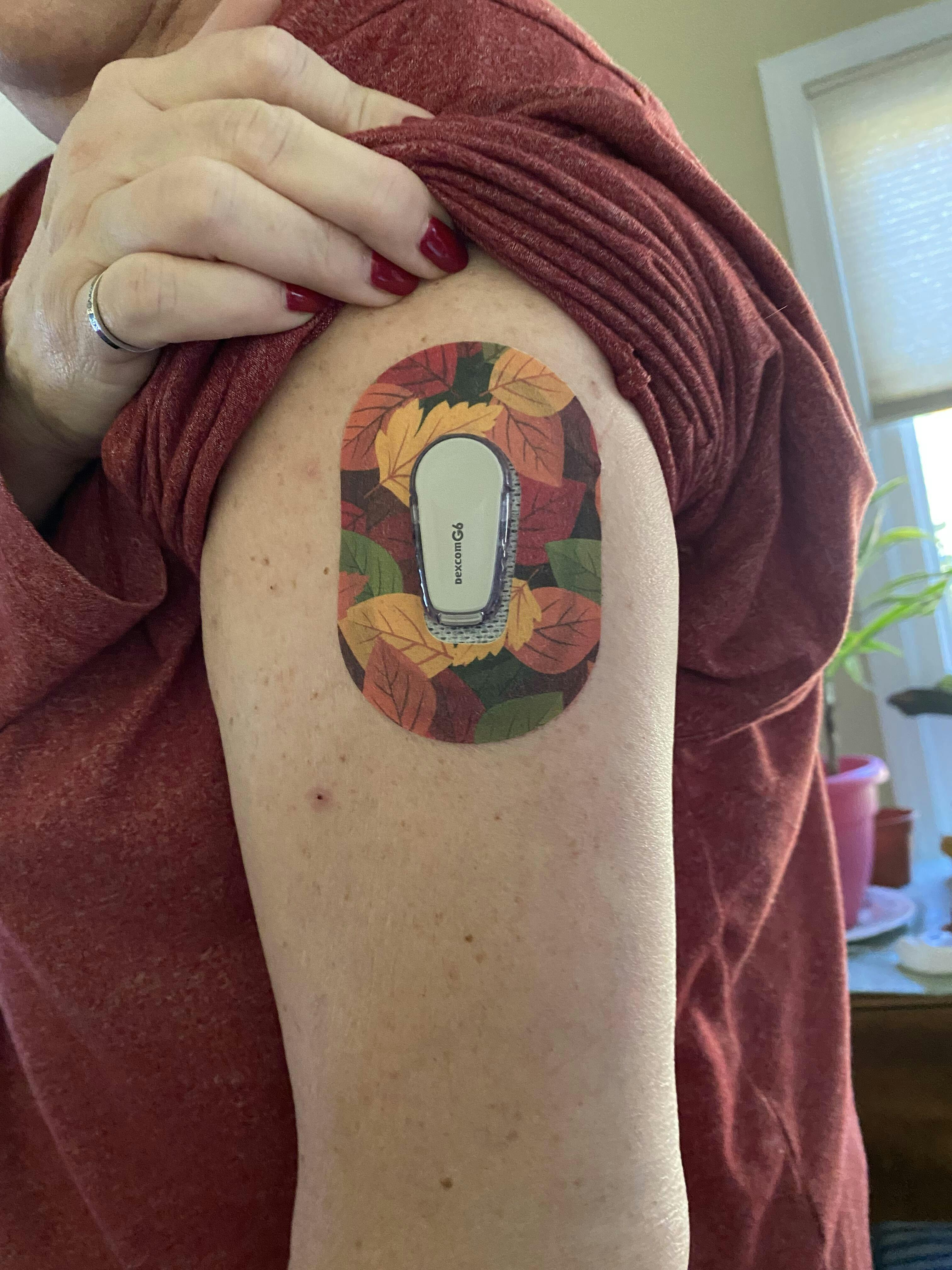 Libre Overlay - For Continuous Glucometer