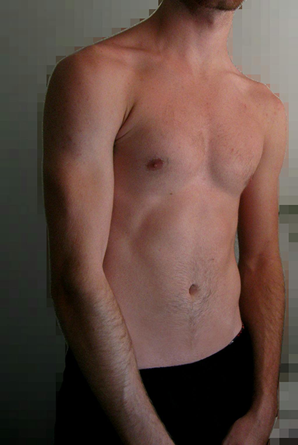 No-Shave Hair Removal Spray - Superior Mane