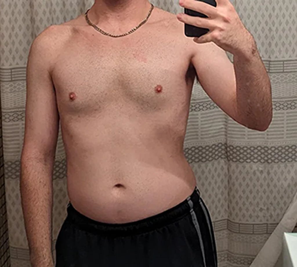 No-Shave Hair Removal Spray - Superior Mane