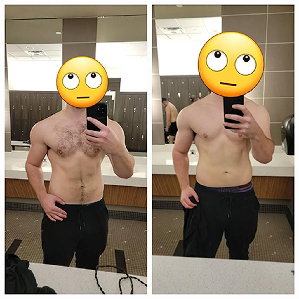 No-Shave Hair Removal Spray - Superior Mane