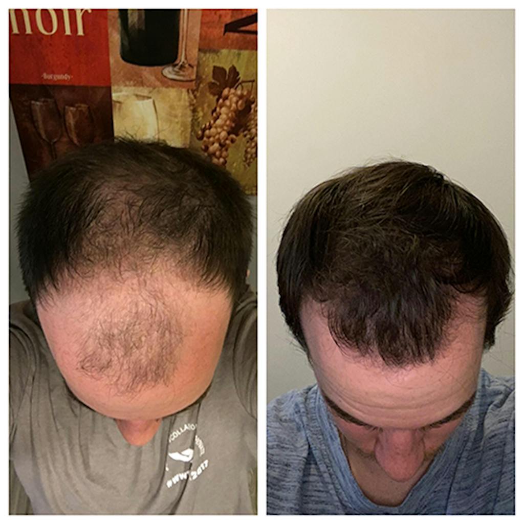 Everyday Essentials Bundle - Sale - Superior Mane