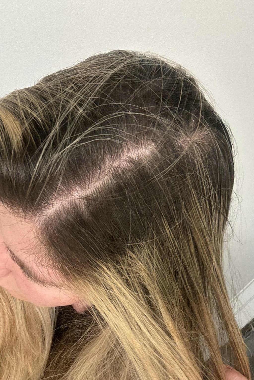 Surface | Awaken Treatment | Revitalize & Strengthen Hair – Surface Hair