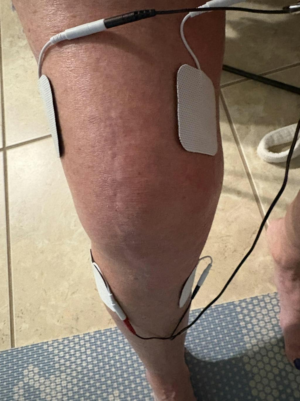 TENS 7000 Rechargeable TENS Unit - Conquer Your Pain