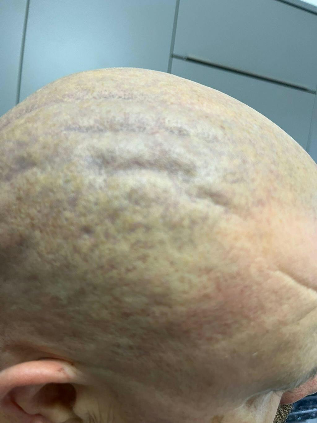 The Bald Brothers Reviews - We Love Our Customers & They Love Our Products